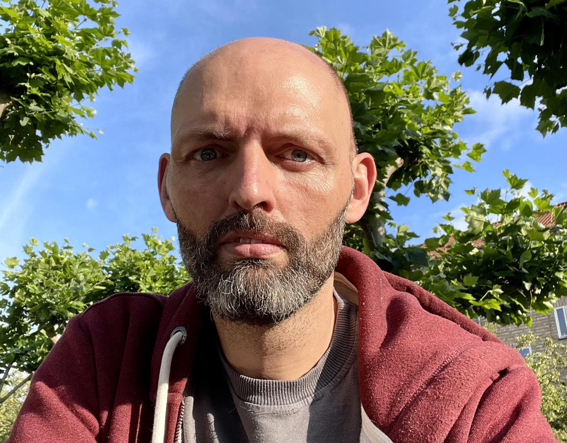 Månedens Bog - Benamputeret - Menneskebiblioteket